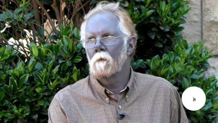 Blue People: Truth Behind the Rare Genetic Condition - imaginaryhistory.com